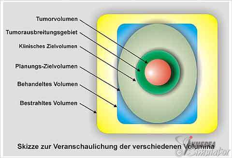 Strahlentherapeutische Volumina